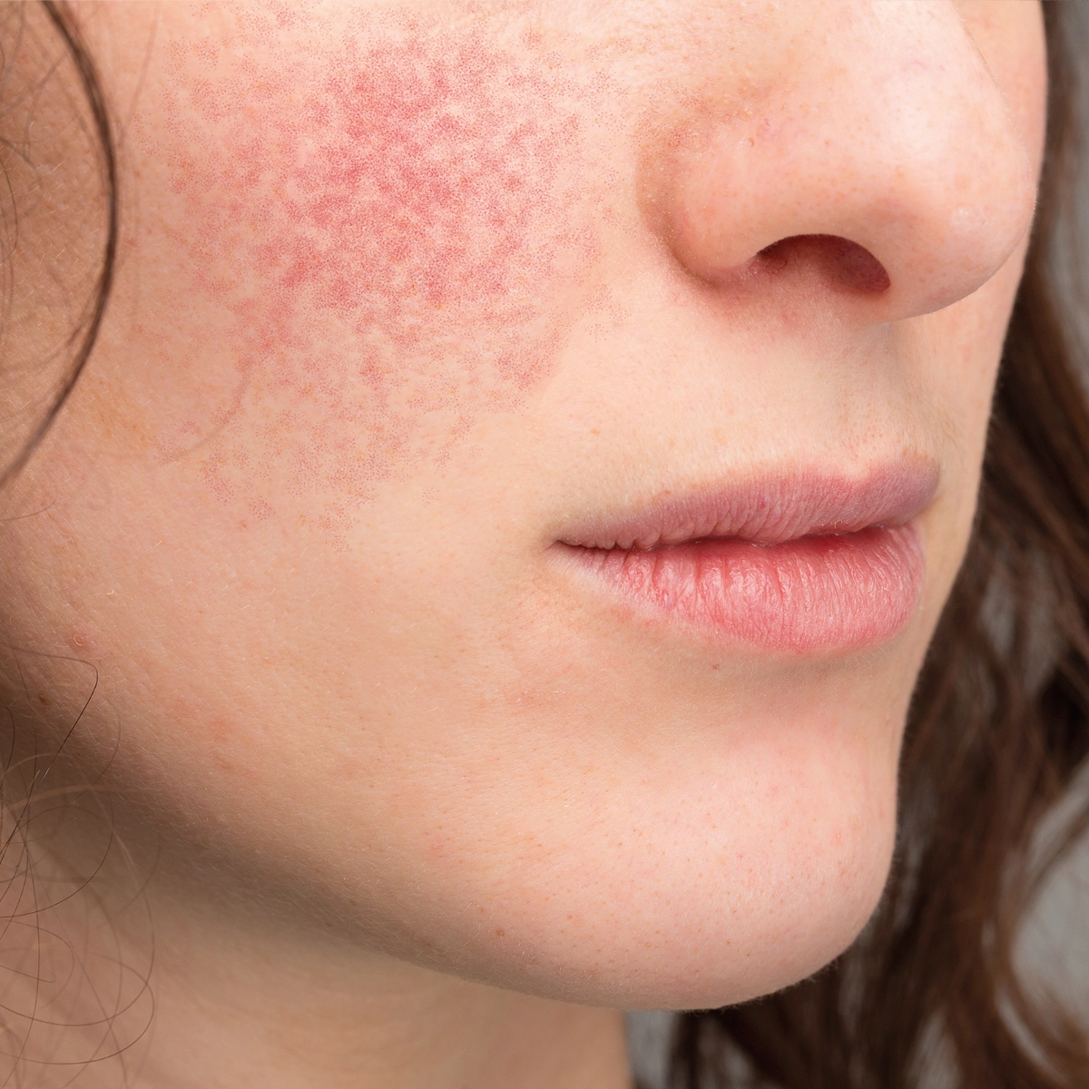 Dermatological face and body care | Louis Widmer