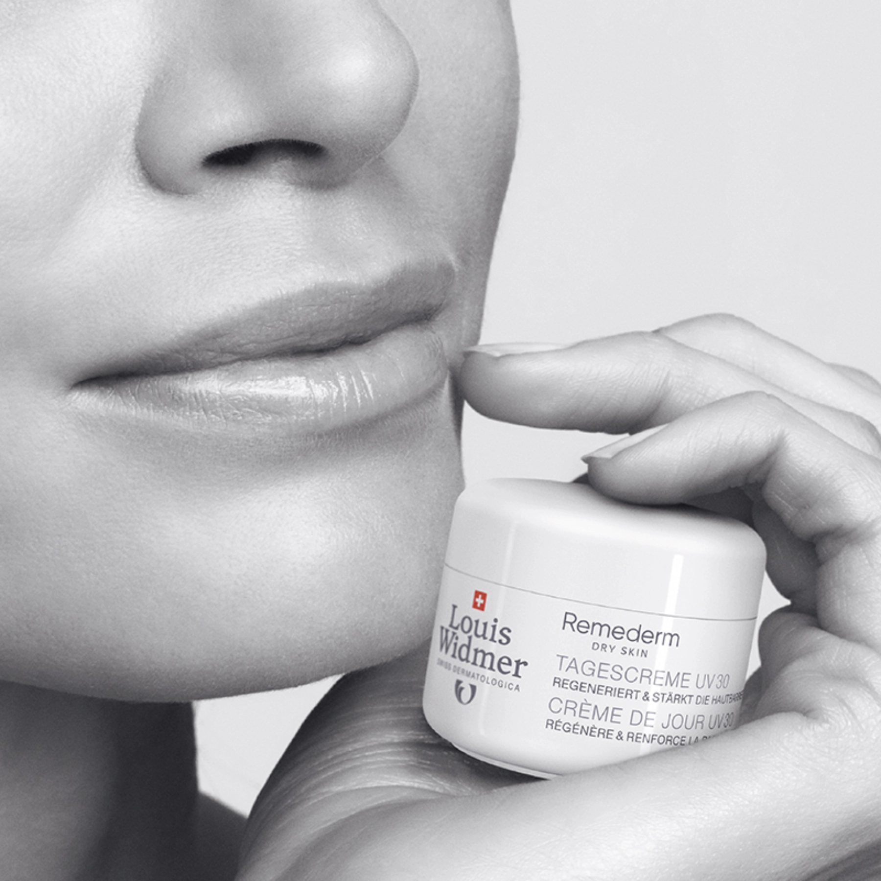 Remederm dry skin | Louis Widmer