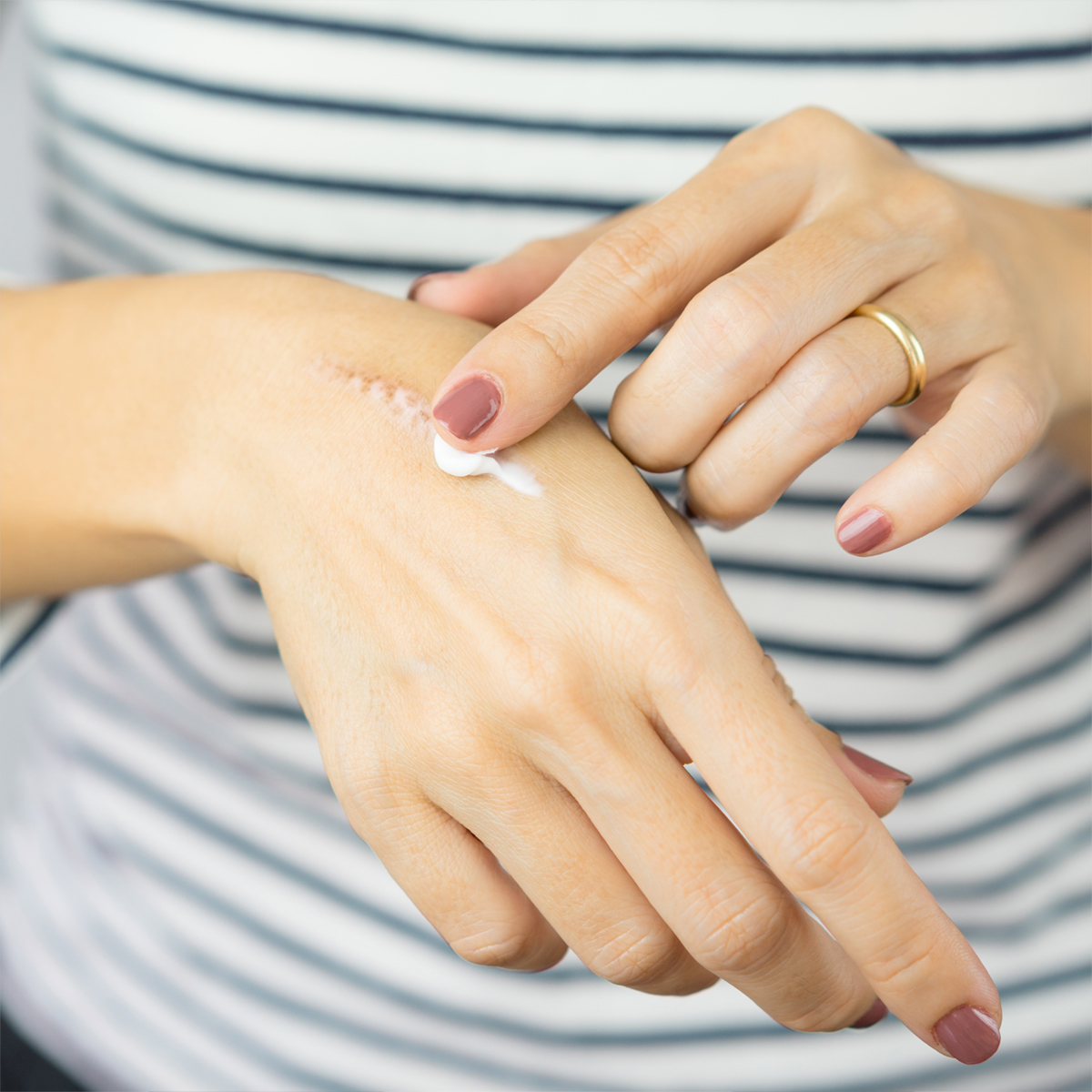 Wonden | Louis Widmer